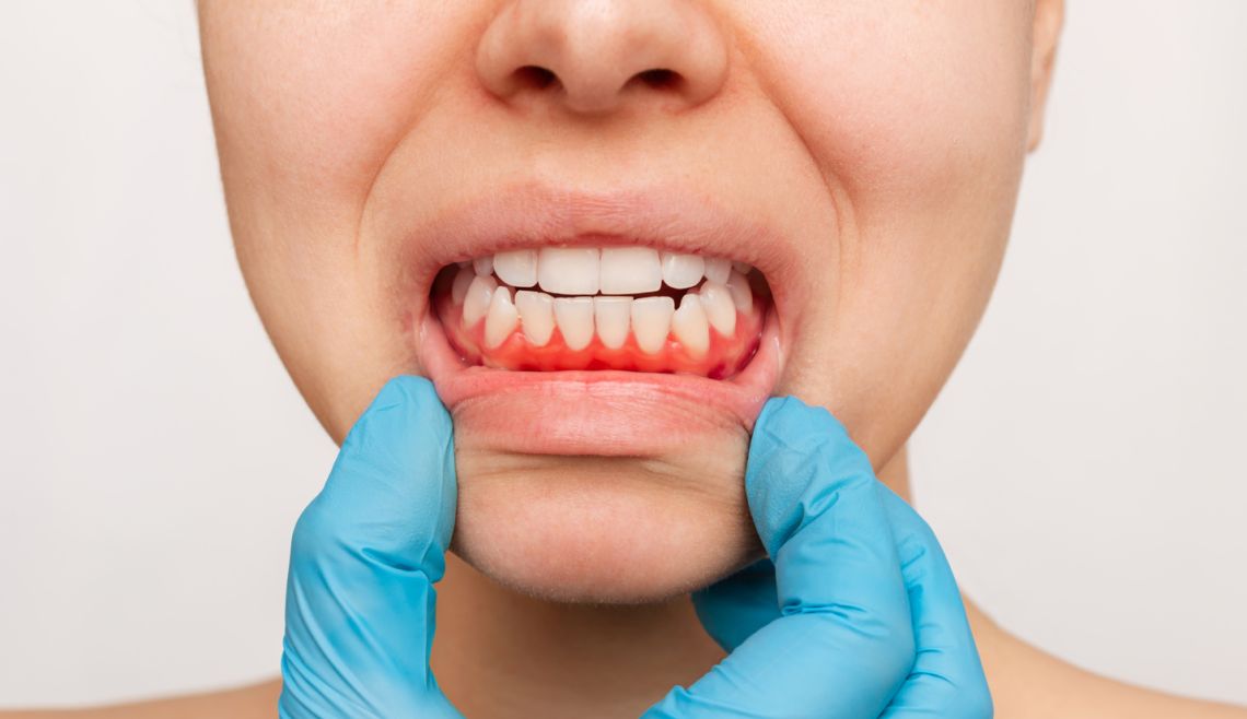 The Cornerstone of a Healthy Smile: Understanding & Enhancing Your Gum ...